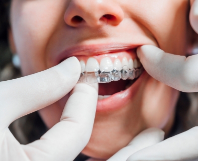 Stourbridge Dentist Near Me - Stourbridge Dental